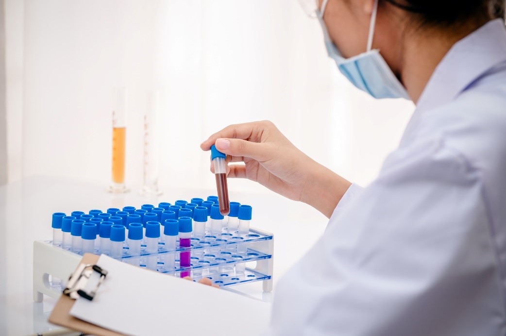 What You Need to Know About Alcohol Testing - Drug Screen Compliance