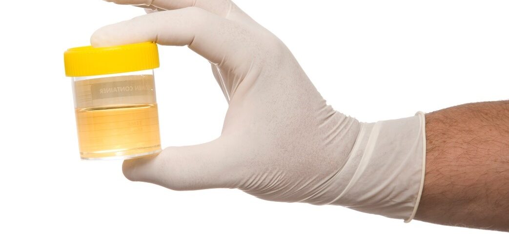 The Importance Of Pre Employment Drug Testing Drug Screen Compliance The Importance Of Pre Employment Drug Testing Drug Screen Compliance