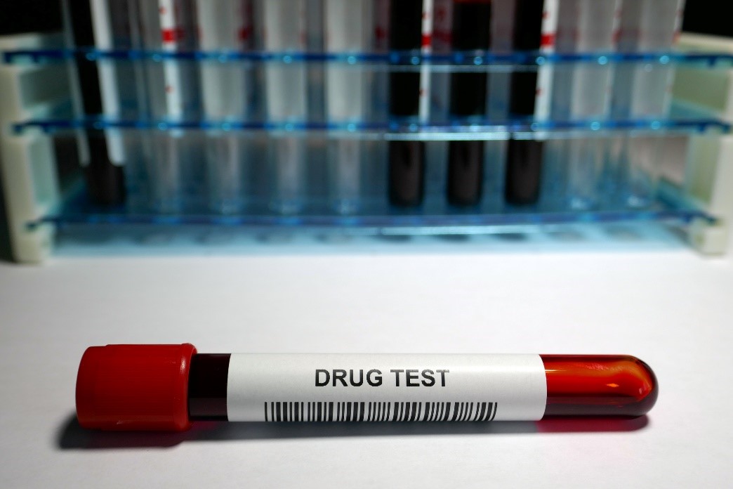 Commonly Used Alternate Samples for Drug Testing - Drug Screen Compliance